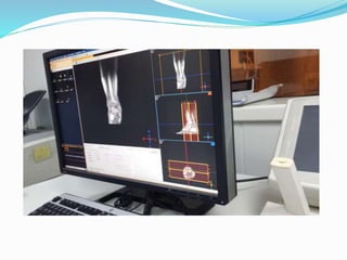 MRI- ankle techniques | PPTX