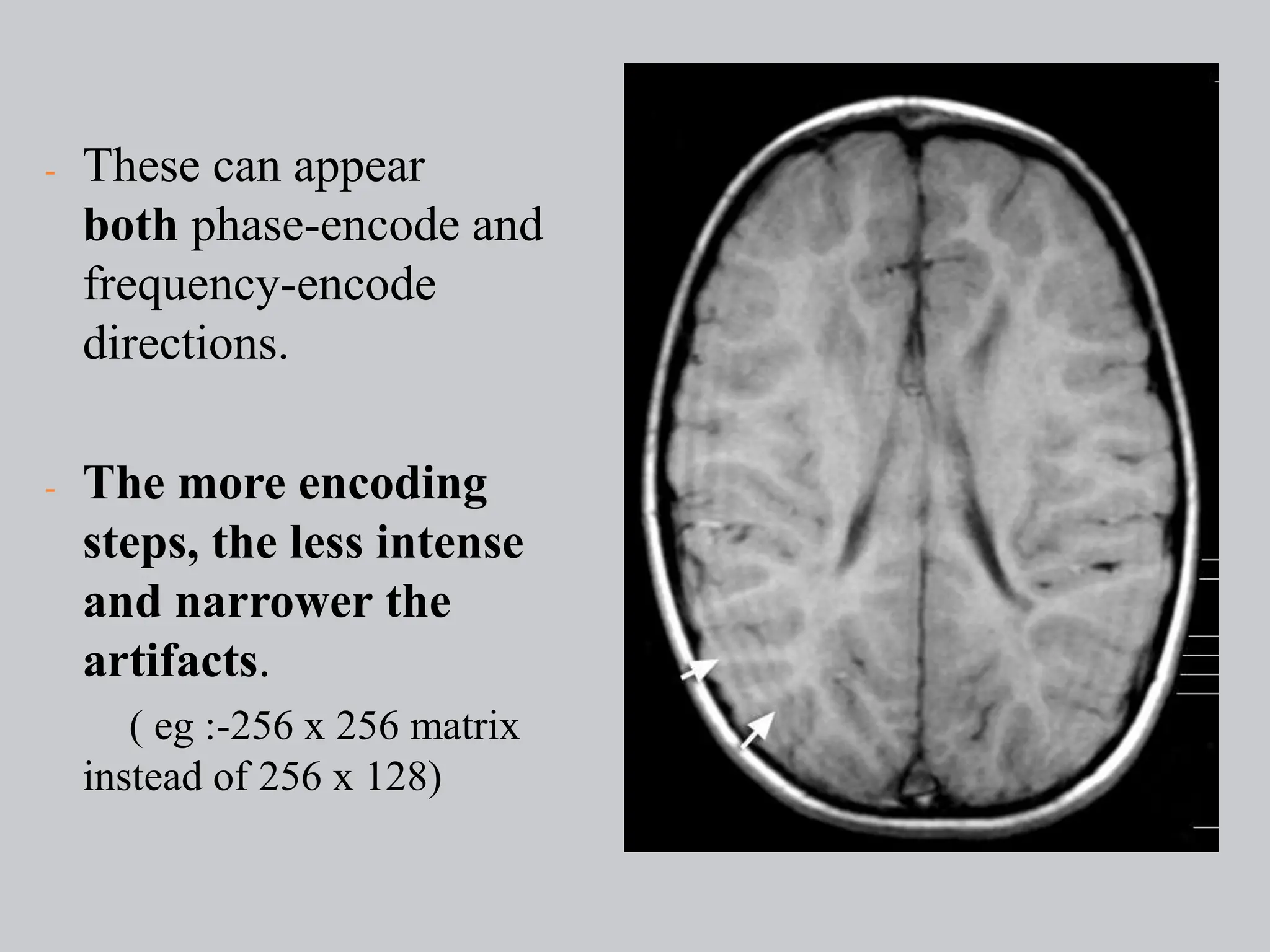 mri artefacts.pptx