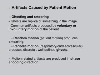 mri artefacts.pptx