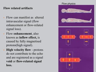 mri artefacts.pptx
