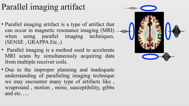 Magnetic Resonance Imaging Artefacts ppt. | PPTX