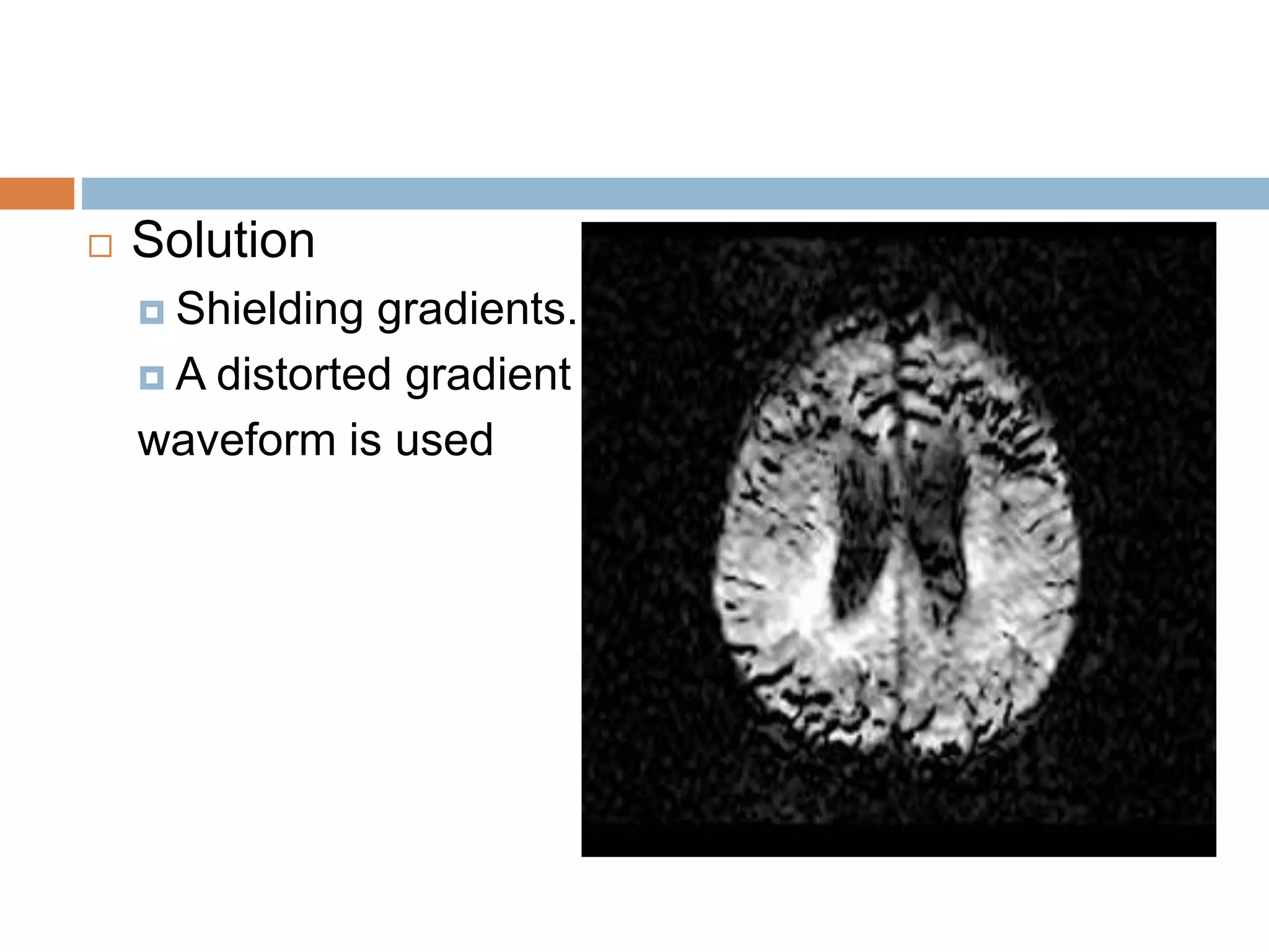 Mri artifacts | PPTX