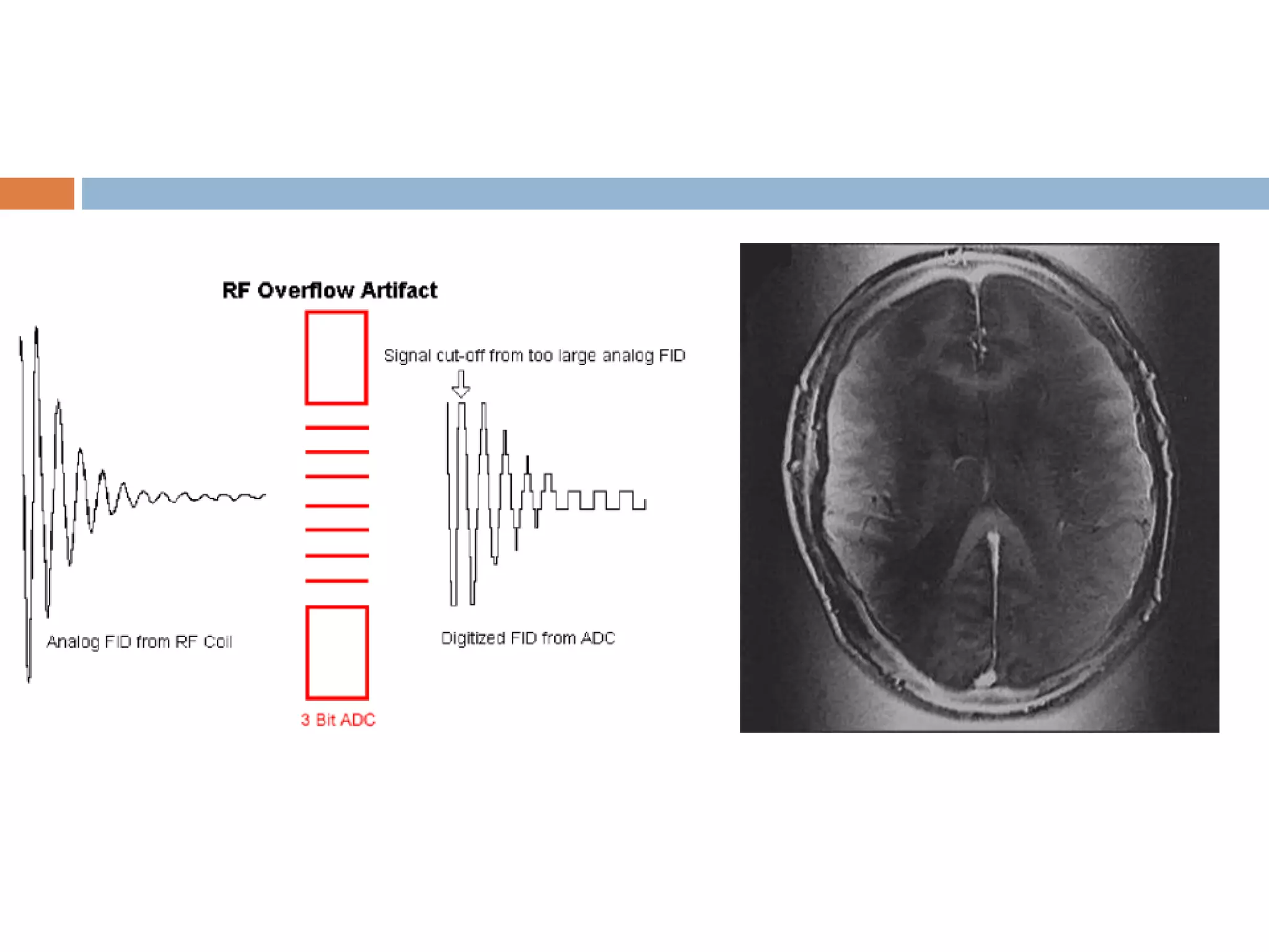 MRI Artifacts | PPTX