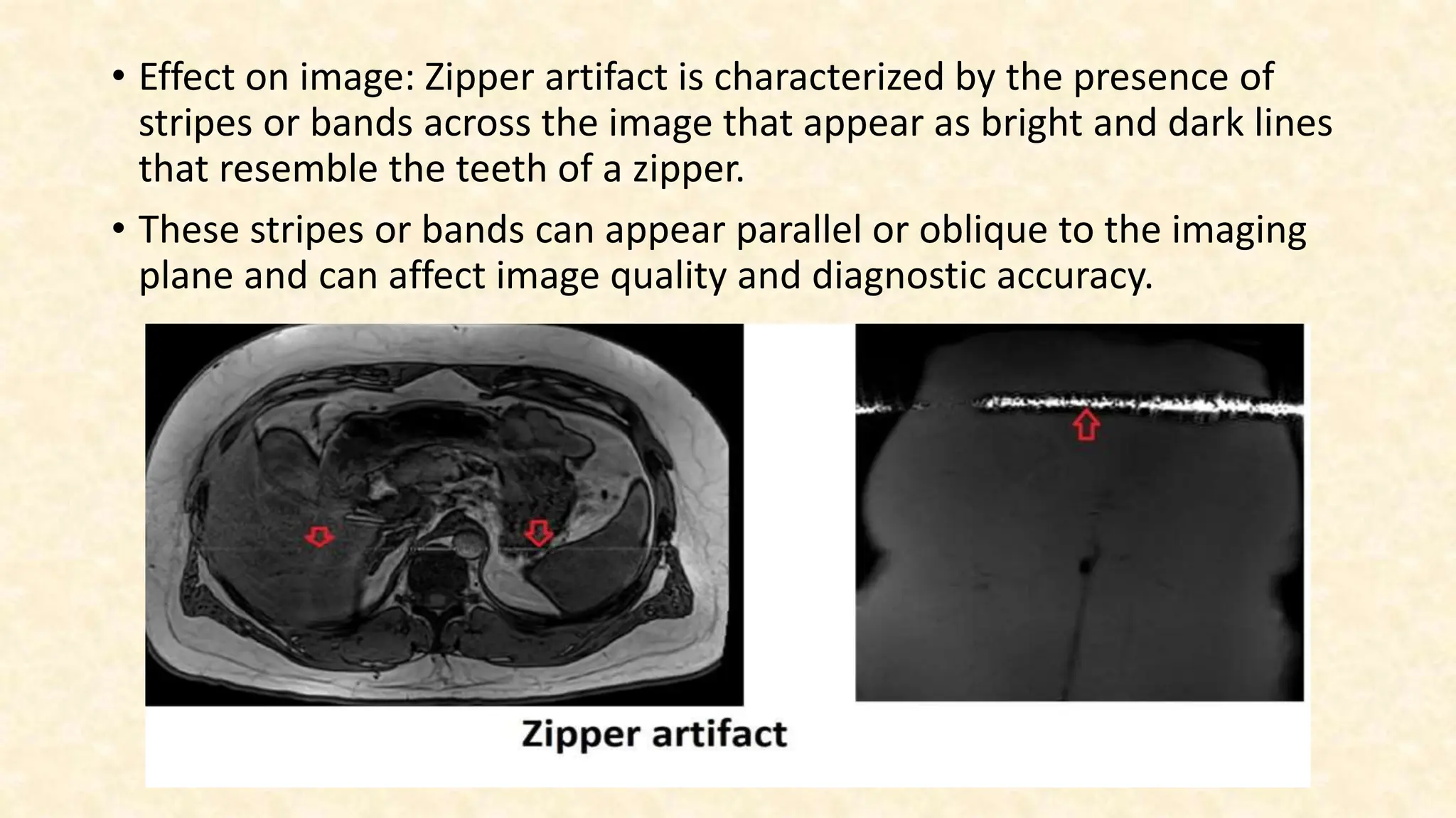 MRI ARTIFACTS.pptx