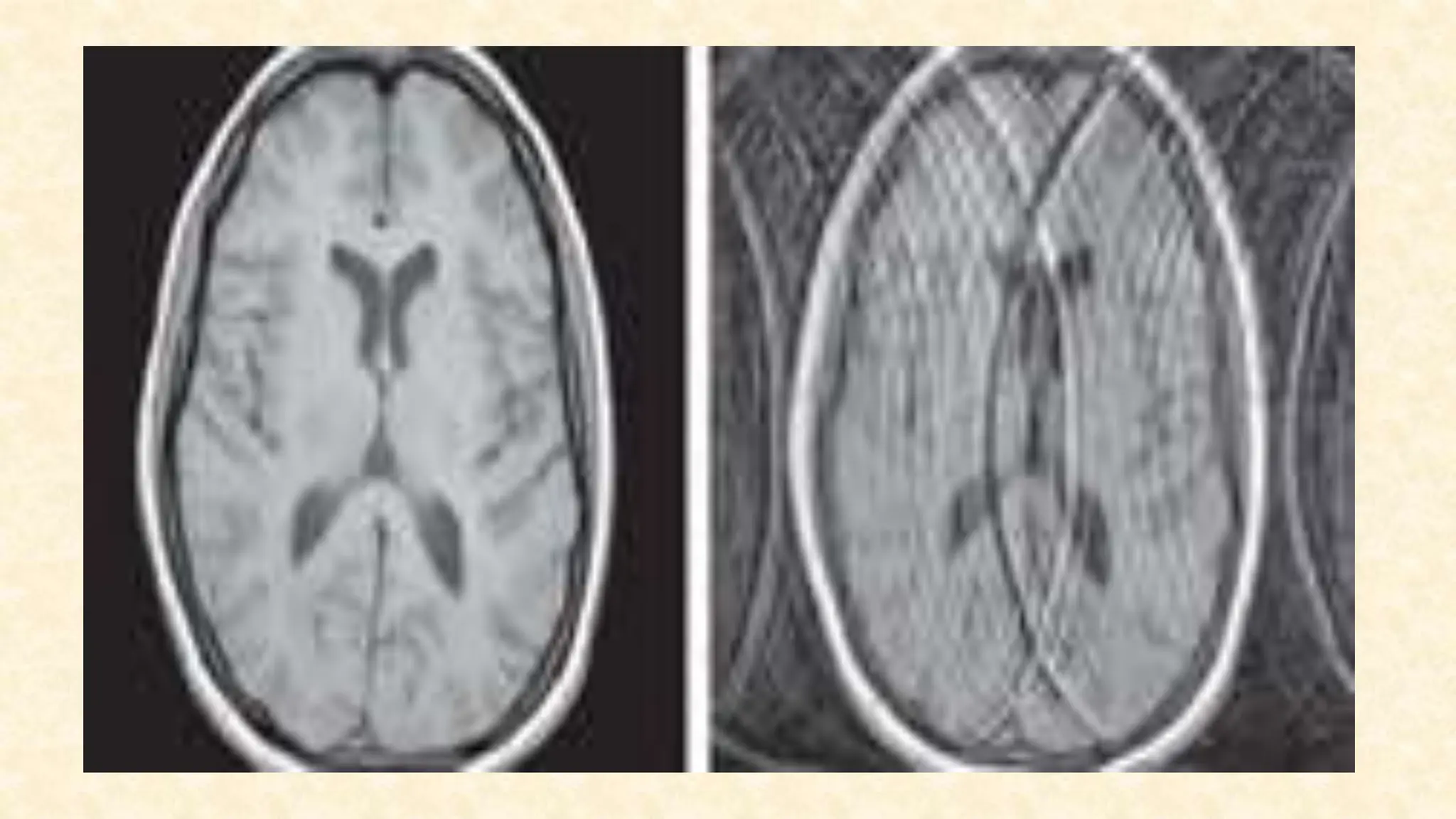 MRI ARTIFACTS.pptx