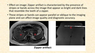 MRI ARTIFACTS.pptx