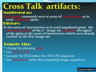 Mri artifacts gamal mahdaly | PPT