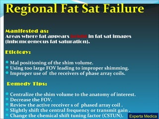 Mri artifacts gamal mahdaly | PPT
