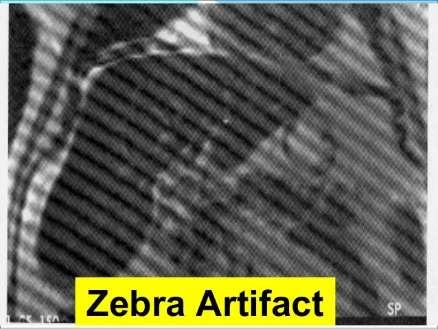 Mri artifacts gamal mahdaly