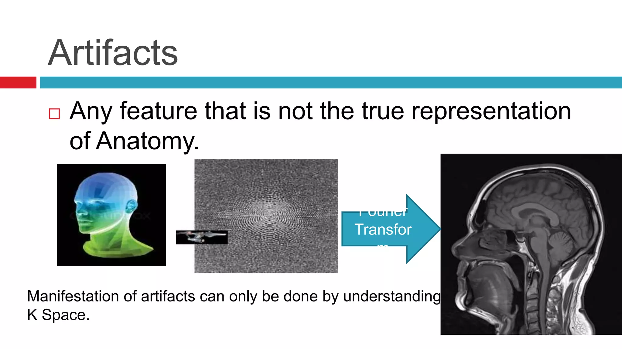 MRI Artefacts | PPTX