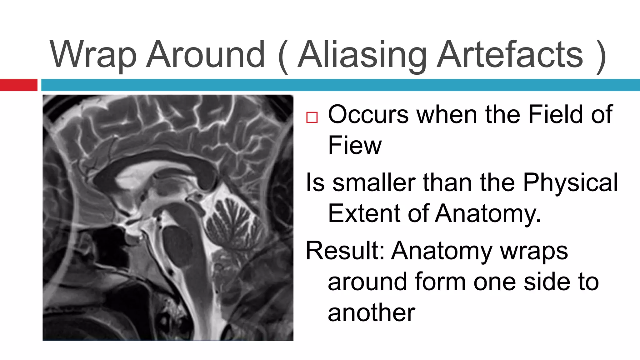 MRI Artefacts | PPTX