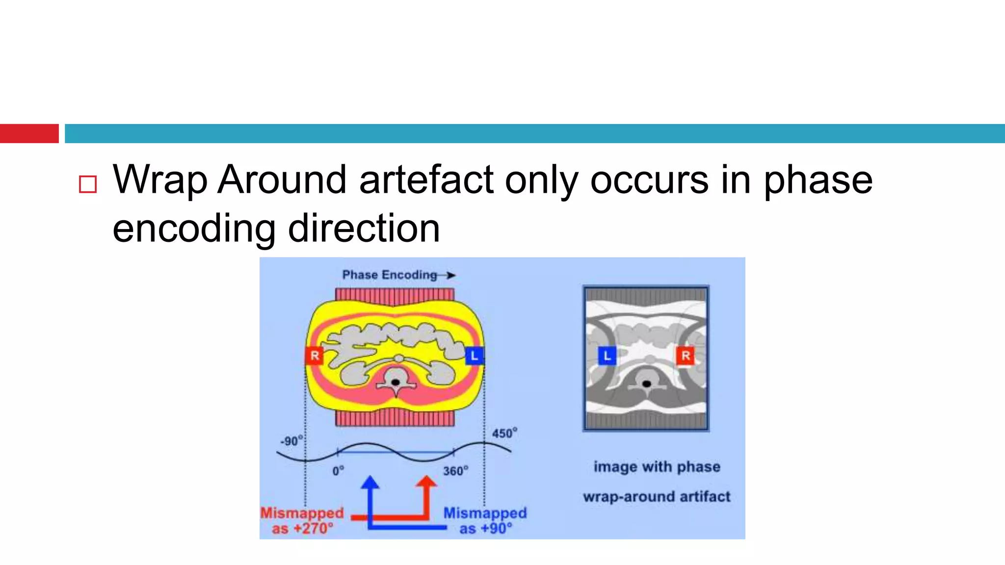MRI Artefacts | PPTX