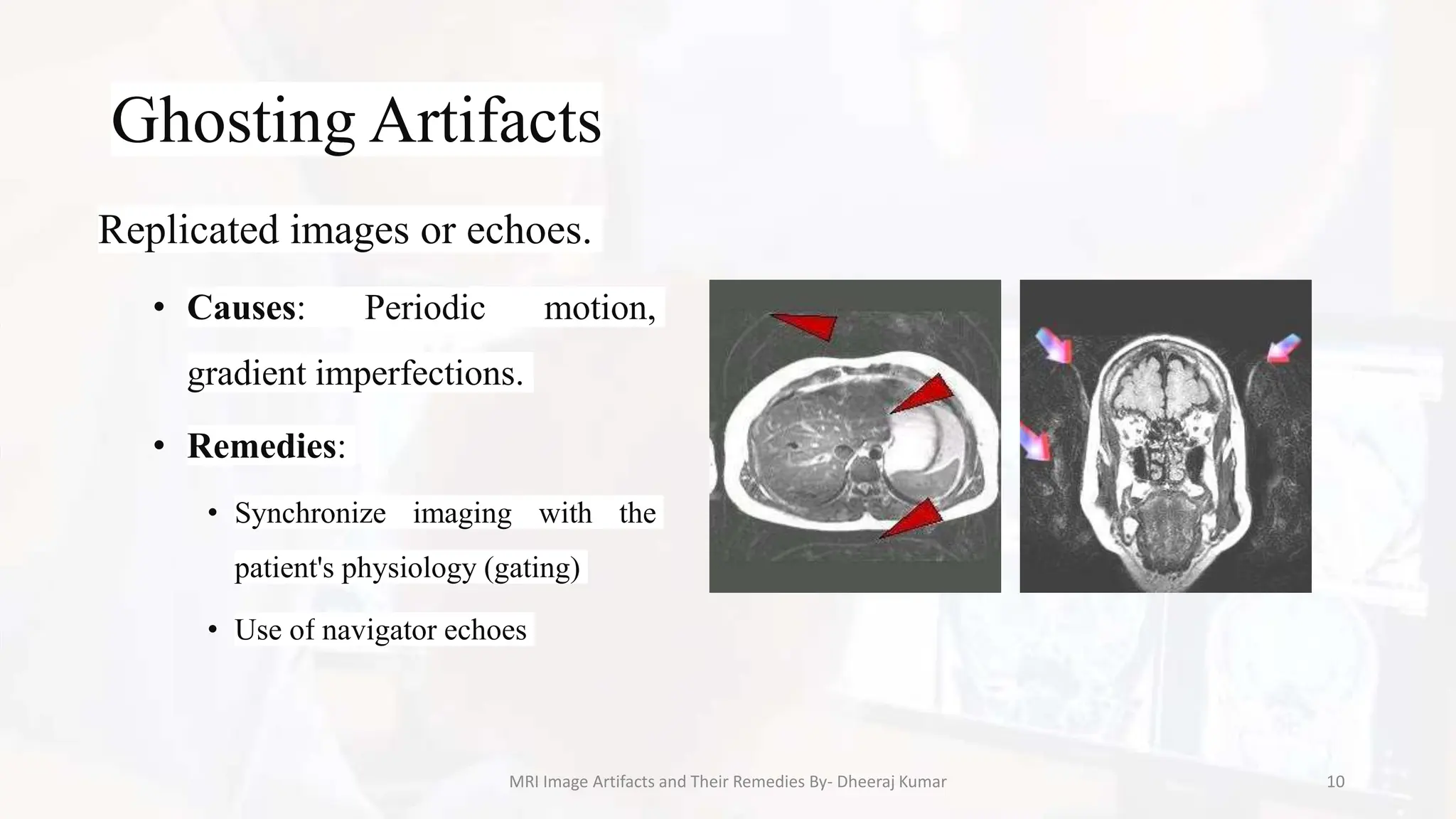 MRI Artifacts and Their Remedies/Corrections.pptx
