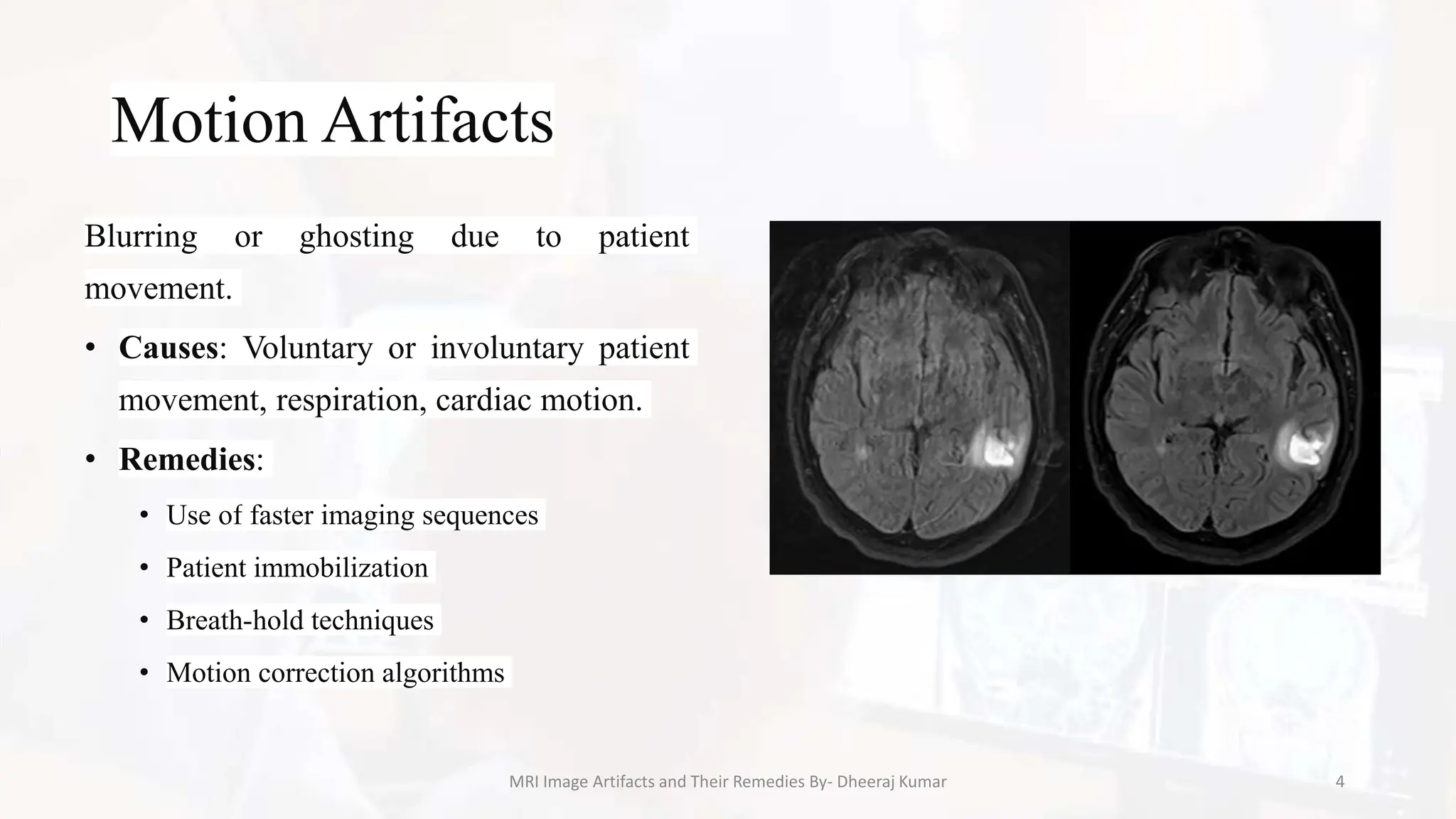 MRI Artifacts and Their Remedies/Corrections.pptx