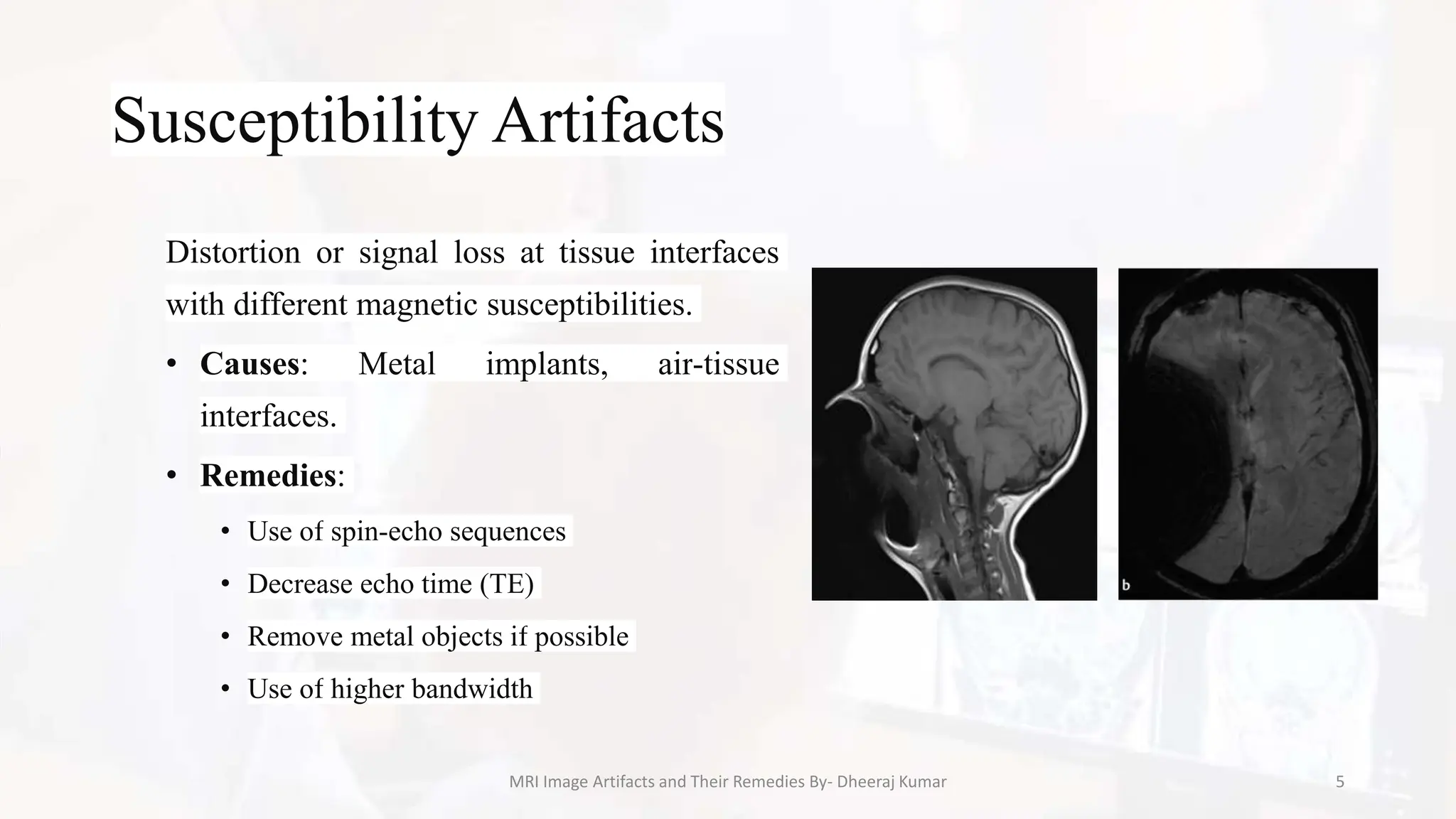 MRI Artifacts and Their Remedies/Corrections.pptx
