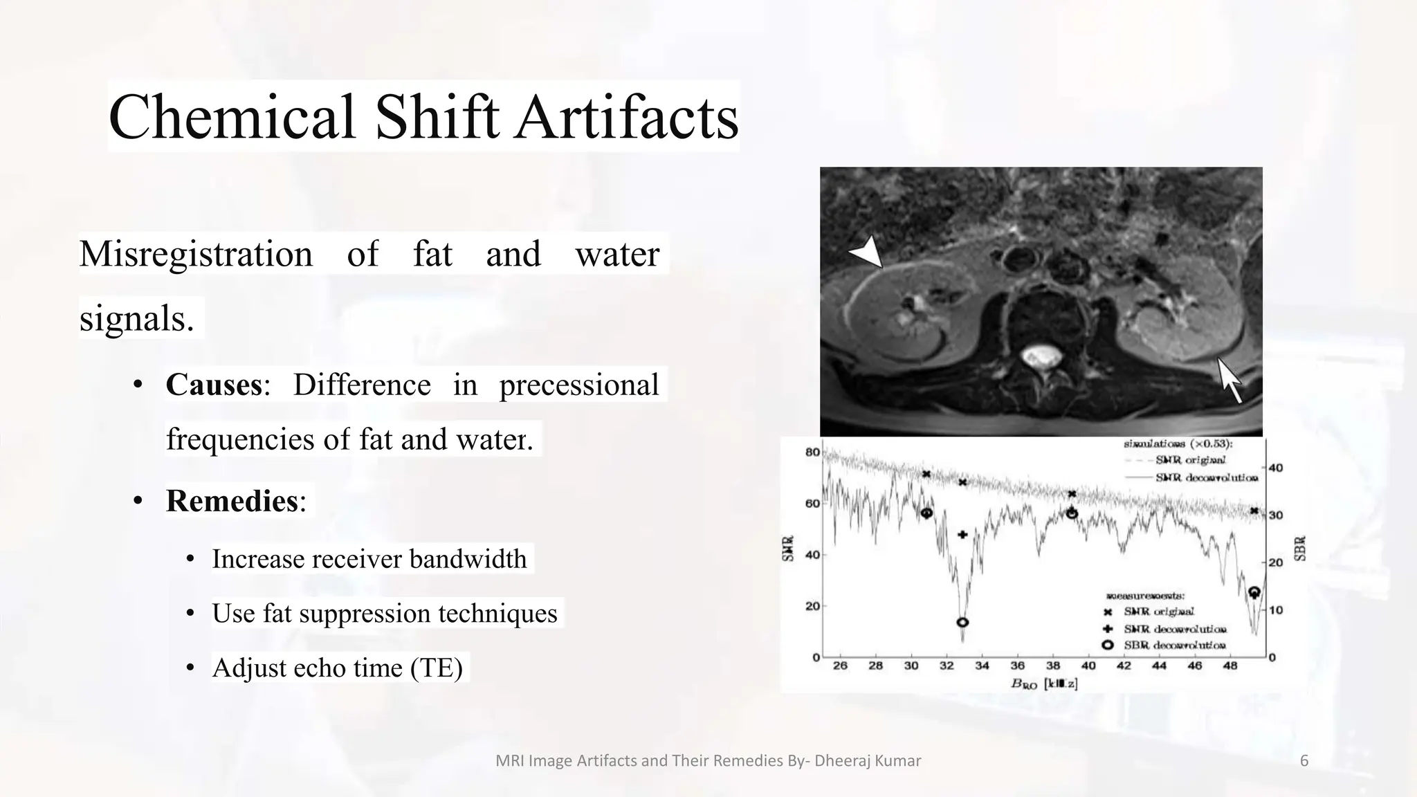 MRI Artifacts and Their Remedies/Corrections.pptx