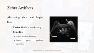 MRI Artifacts and Their Remedies/Corrections.pptx | Medical Tests ...