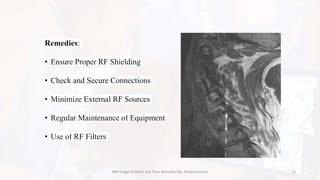 MRI Artifacts and Their Remedies/Corrections.pptx