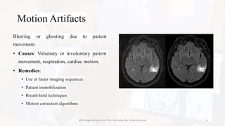 MRI Artifacts and Their Remedies/Corrections.pptx | Medical Tests ...
