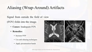 MRI Artifacts and Their Remedies/Corrections.pptx | Medical Tests ...
