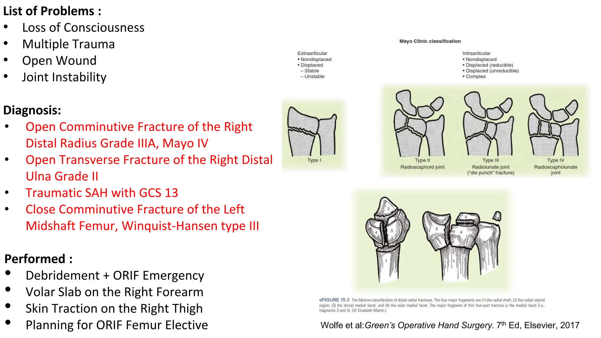 MR IAZ-MRZ finger tip injury left middle finger.pptx