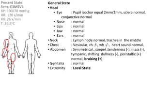 MR IAZ-MRZ finger tip injury left middle finger.pptx