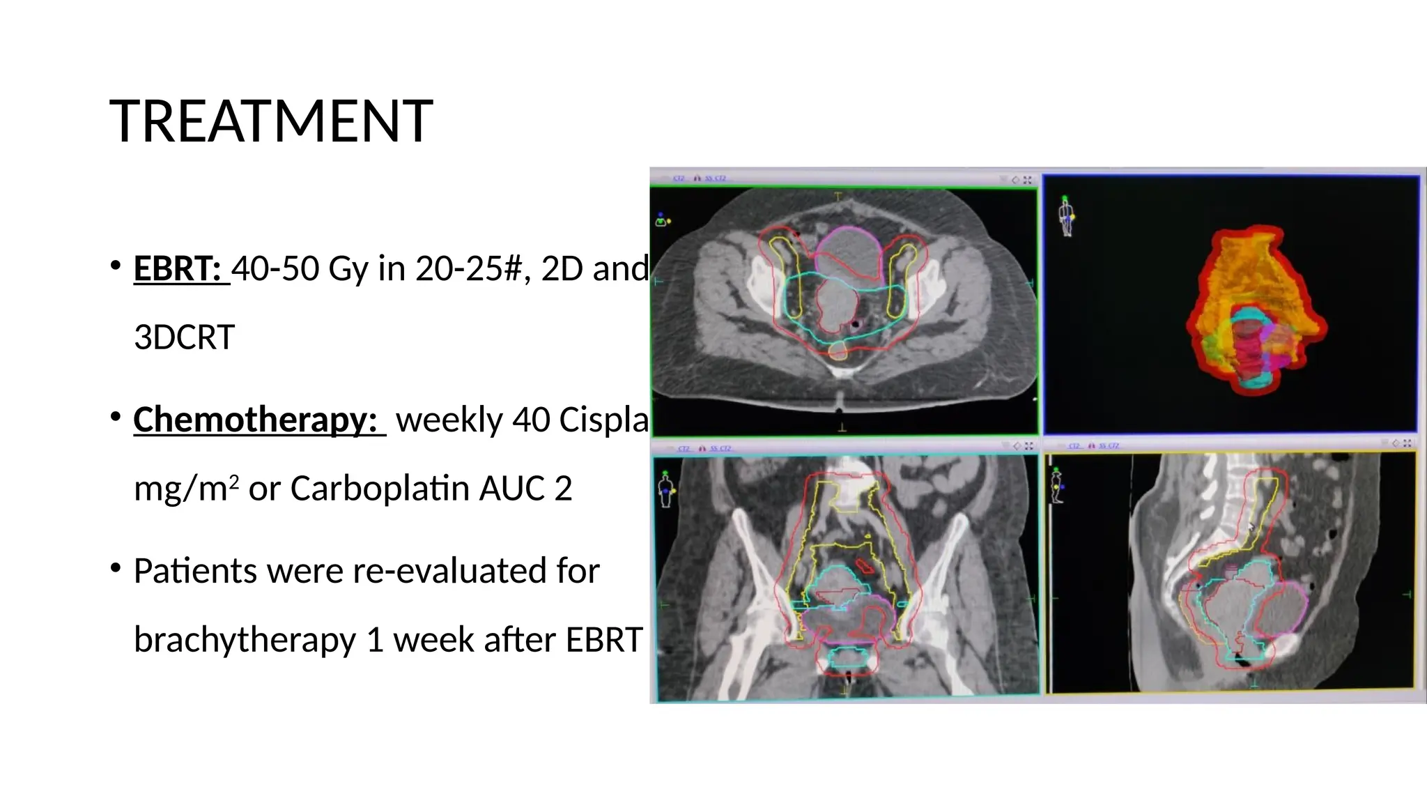 MRI based ICBT in cervical cancer patients | PPTX