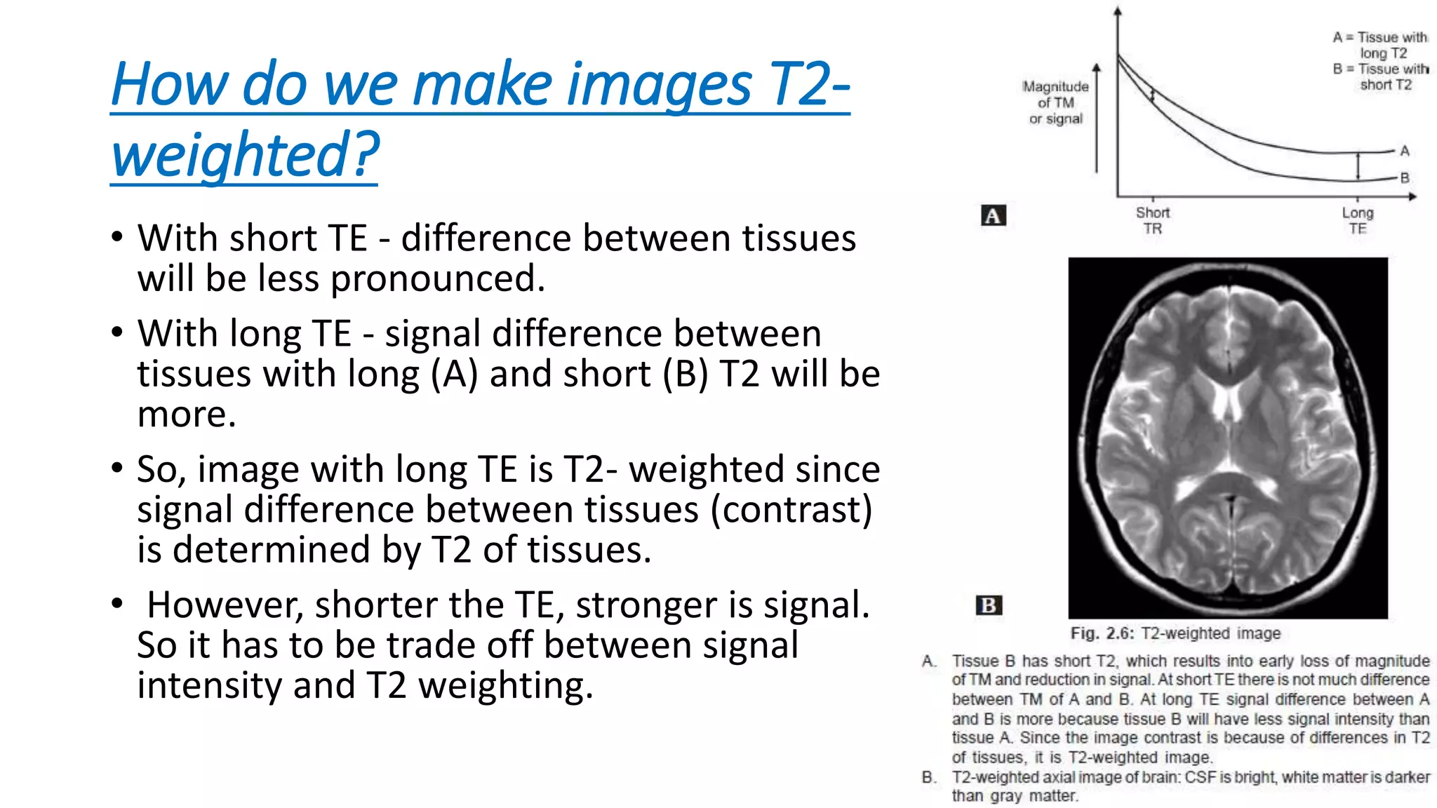 Mri basic principles | PPTX