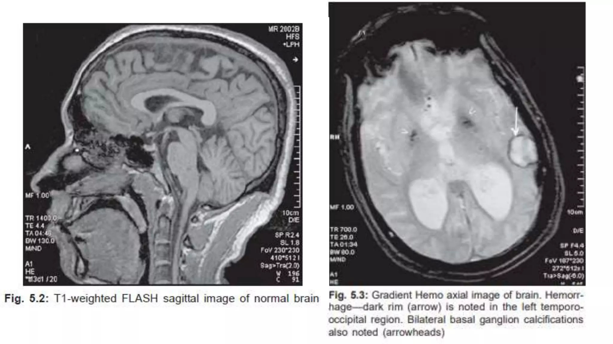 Mri basic principles | PPTX