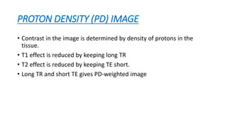 Mri basic principles | PPTX