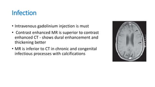 Mri basic principles | PPTX