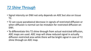 Mri basic principles | PPTX