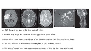 Mri basic principles | PPTX