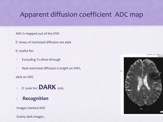 Mri basics | PPTX