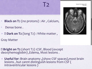 Mri basics | PPTX