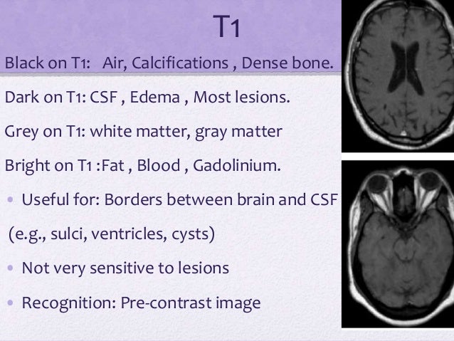 Mri basics