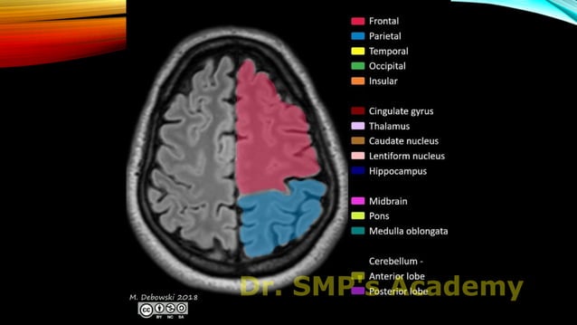 MRI BASICS by dr himashu kaushal_choladeck.pptx