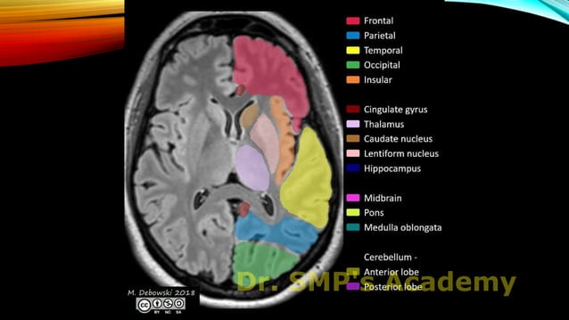 MRI BASICS by dr himashu kaushal_choladeck.pptx