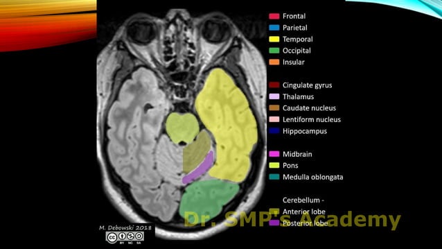 MRI BASICS by dr himashu kaushal_choladeck.pptx