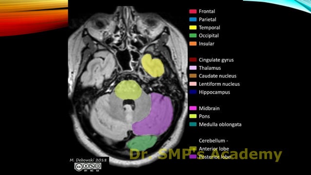 MRI BASICS by dr himashu kaushal_choladeck.pptx