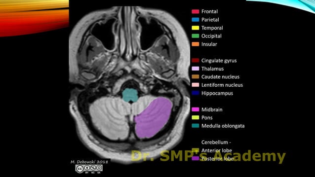 MRI BASICS by dr himashu kaushal_choladeck.pptx