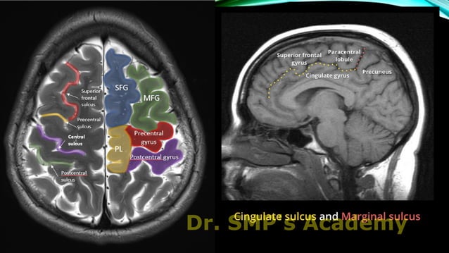 MRI BASICS by dr himashu kaushal_choladeck.pptx