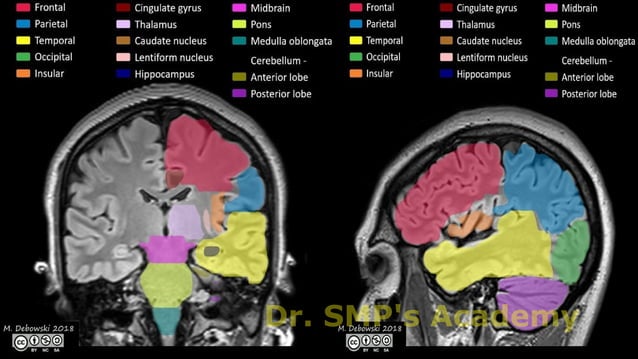 MRI BASICS by dr himashu kaushal_choladeck.pptx
