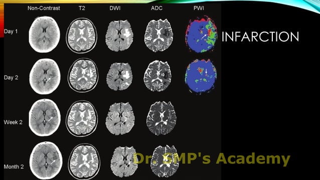 MRI BASICS by dr himashu kaushal_choladeck.pptx