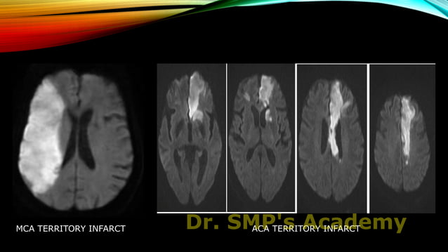 MRI BASICS by dr himashu kaushal_choladeck.pptx