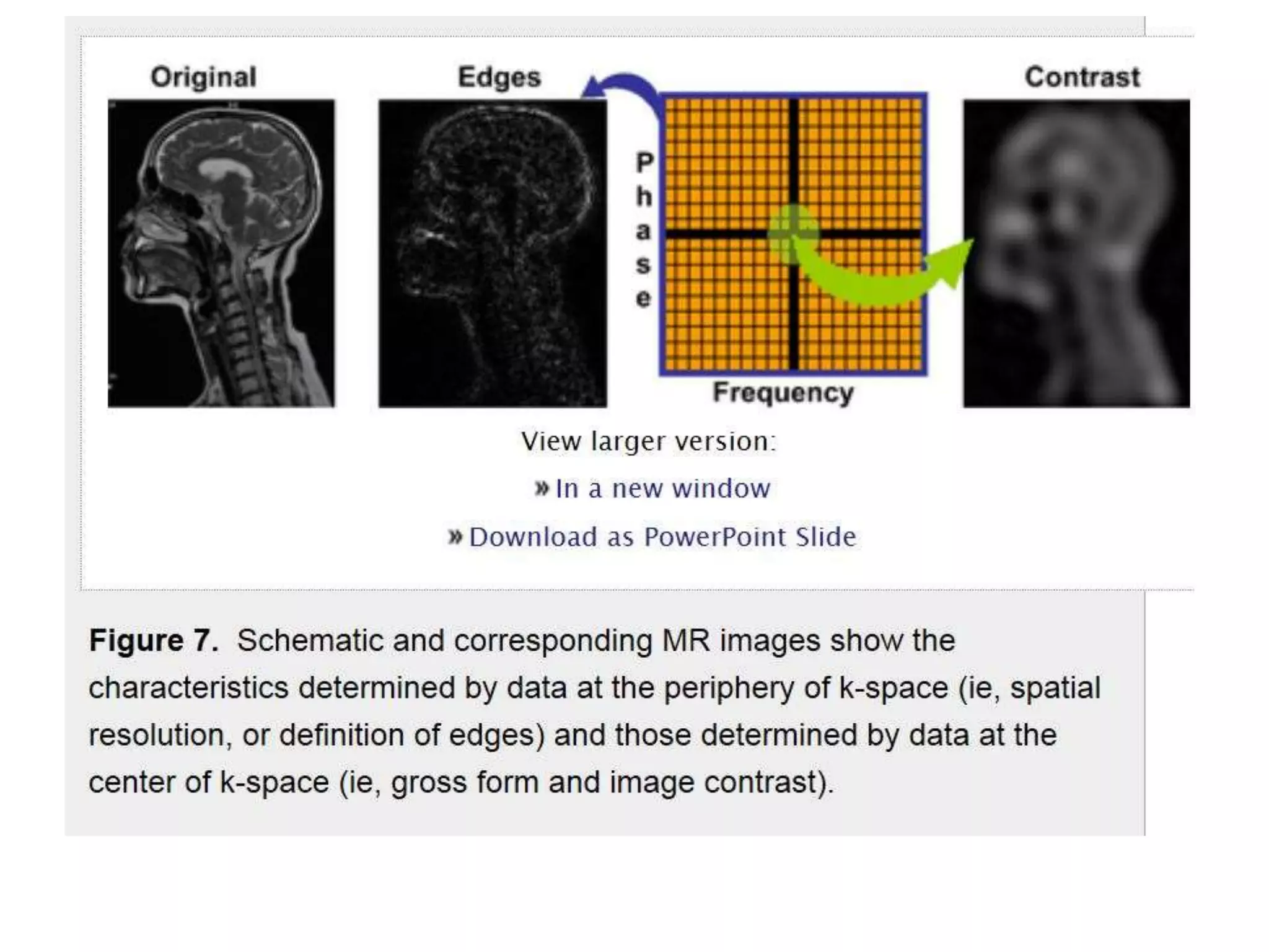 Mri basic sequences | PPTX