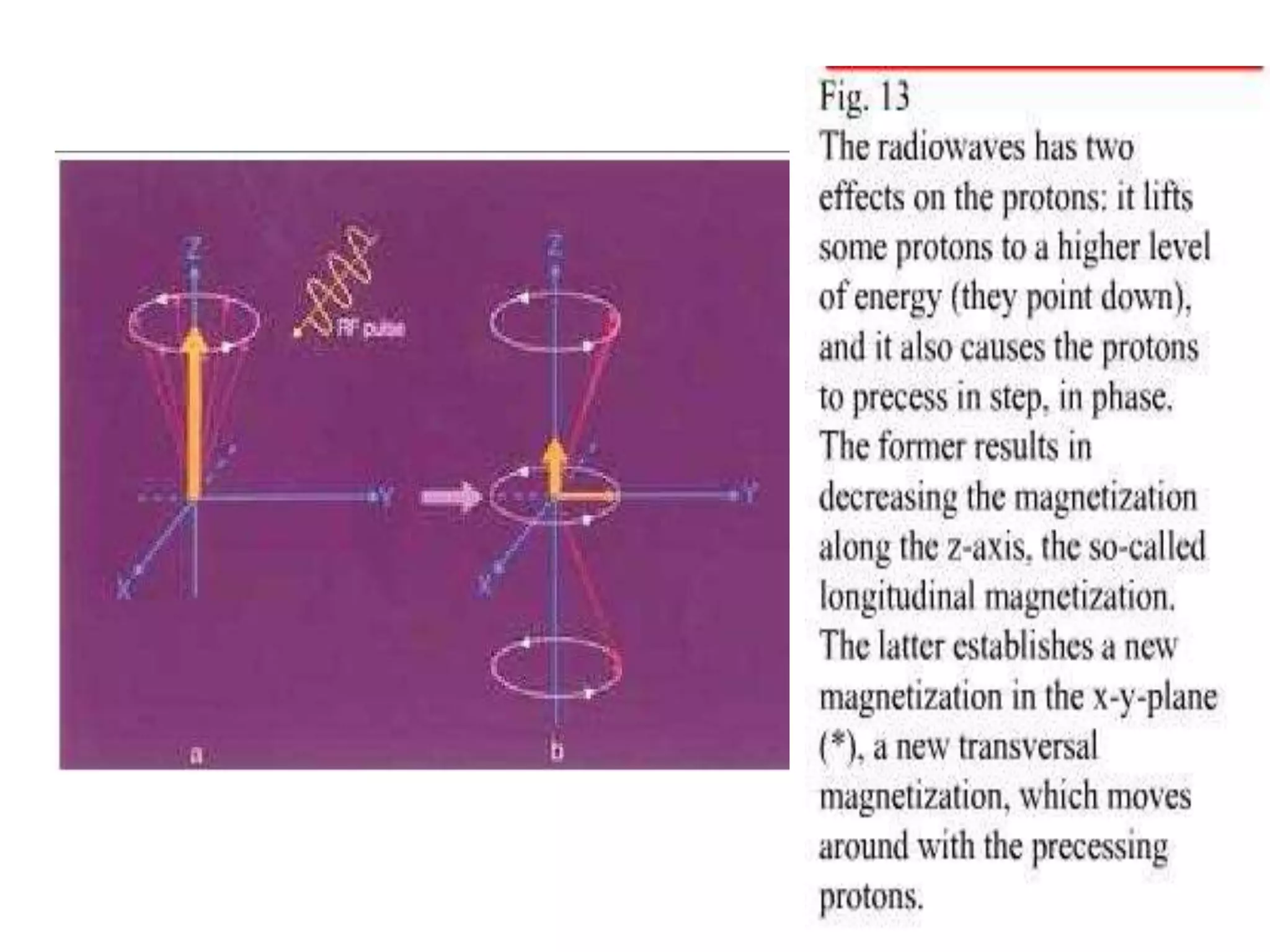 Mri basic sequences | PPTX