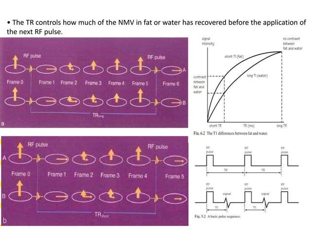 Mri basic sequences | PPTX | Chemistry | Science