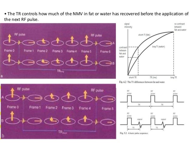 Basic Mri Pulse Sequence
