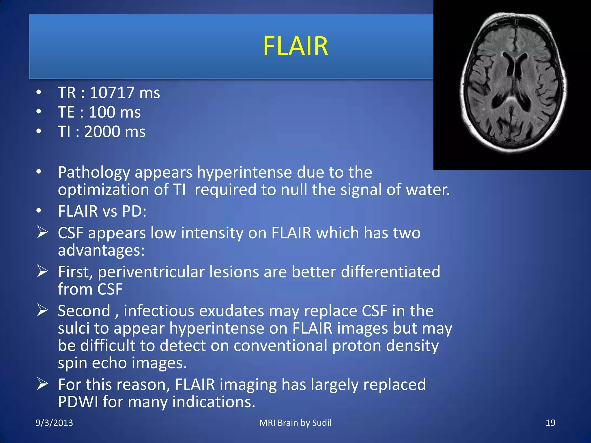MRI Procedure of Brain | PPTX